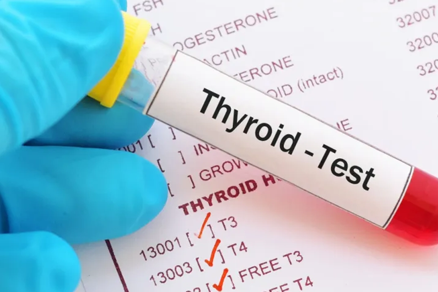 Thyroid test guide: TSH, T3, T4 ranges and what they mean