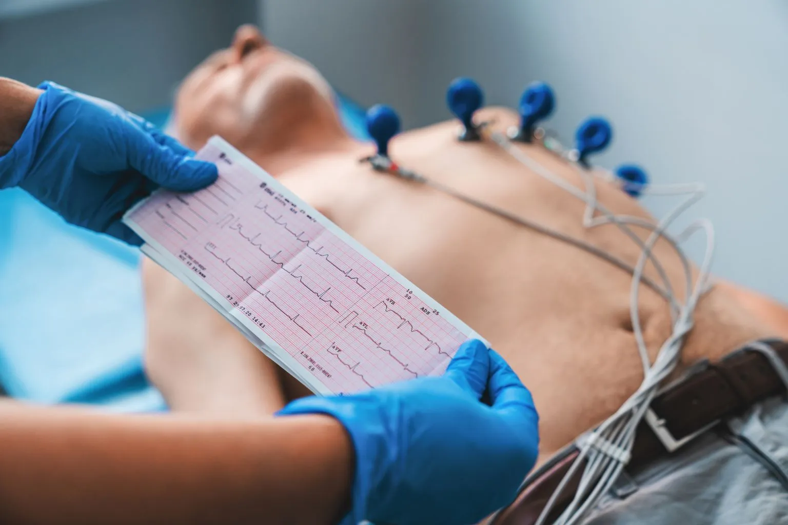 Abnormal ECG readings: When should you be worried?